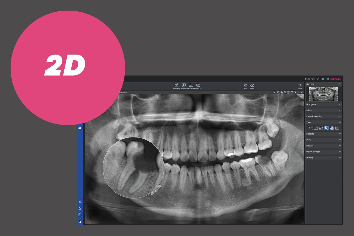 Romexis® 6 – 2D-modulen