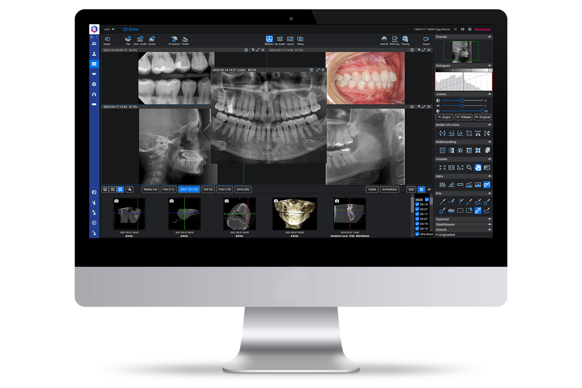 Planmeca Romexis bildhantering