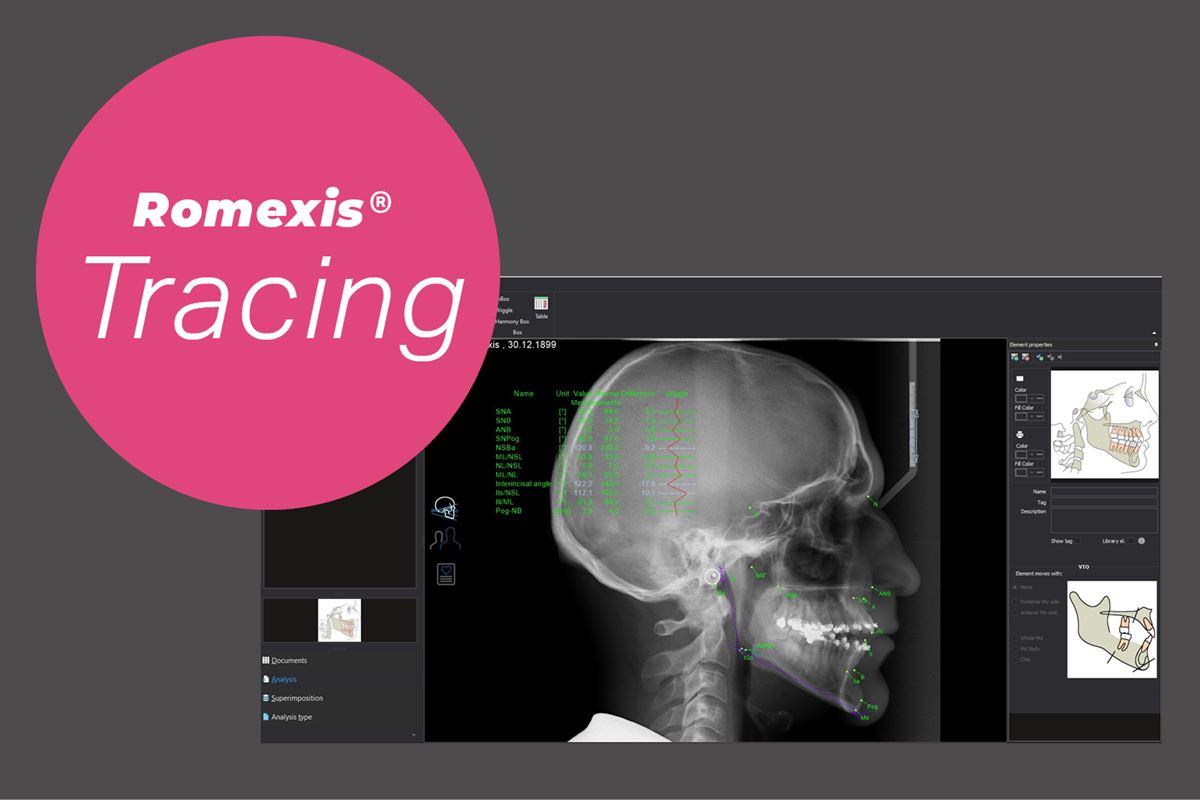 Romexis 6® – Tracing modulen