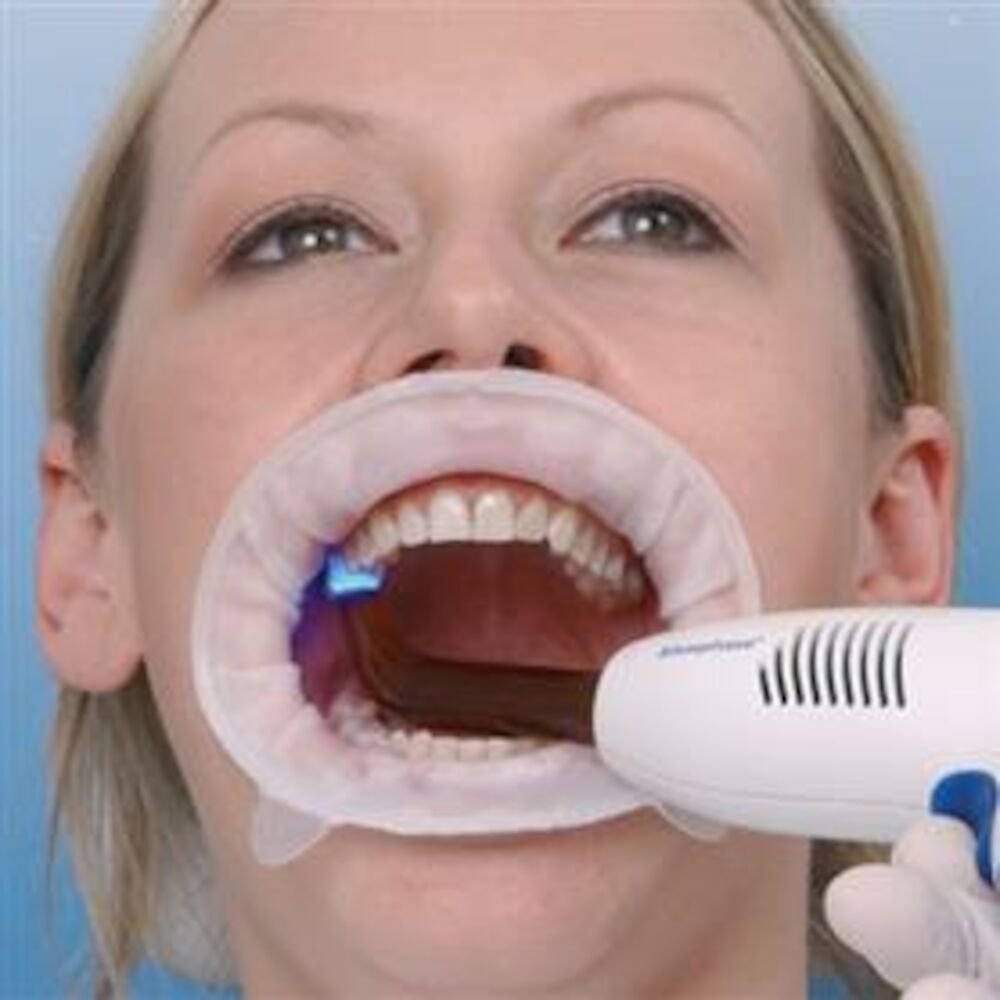 OptraGate Small 1 x 80 st — SE1